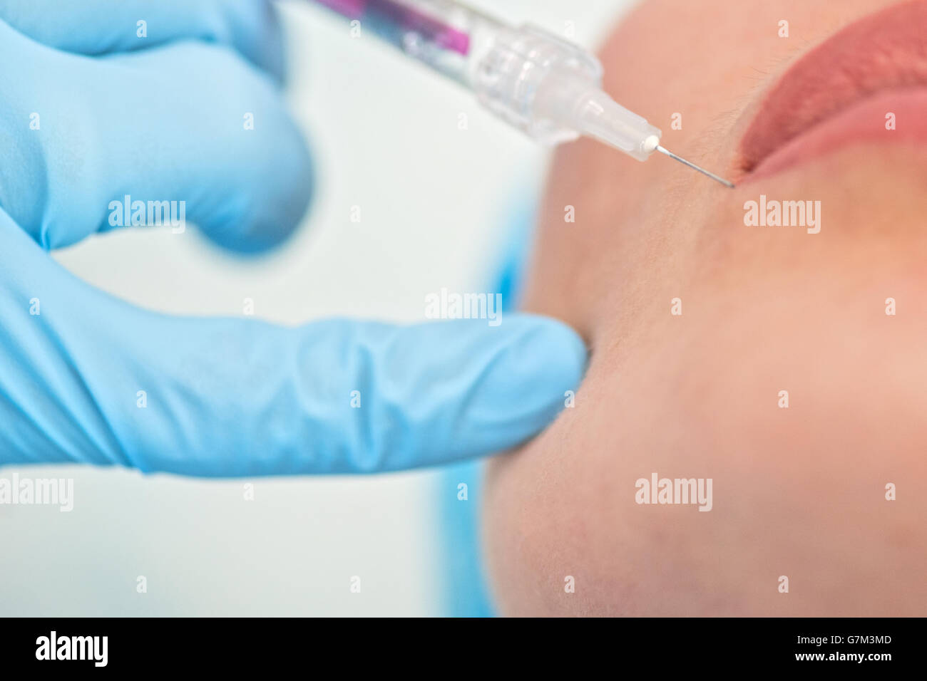 woman gets injection in her lips Stock Photo - Alamy