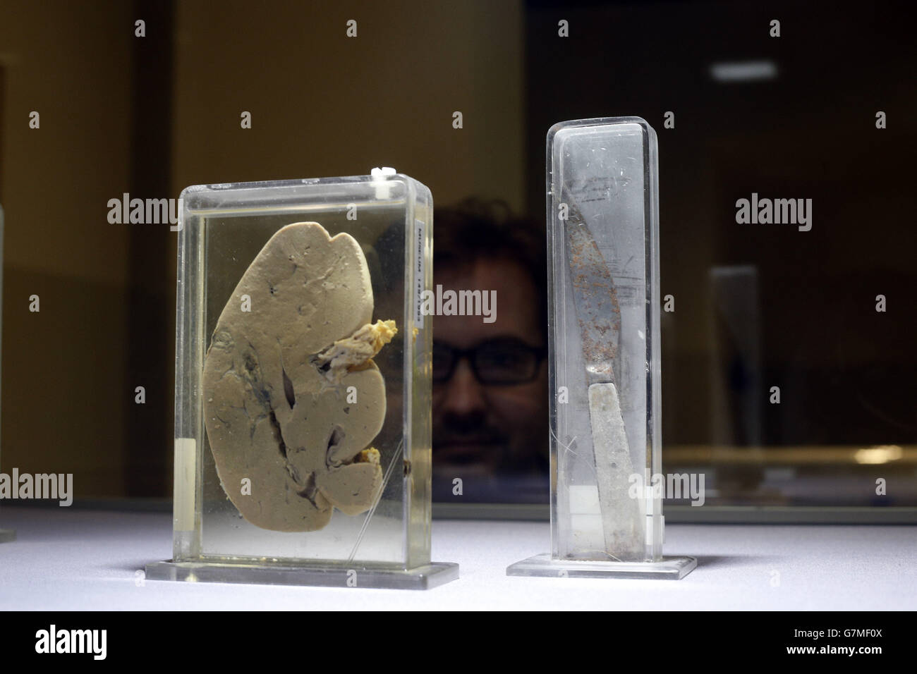 Kidney exhibition hi-res stock photography and images - Alamy