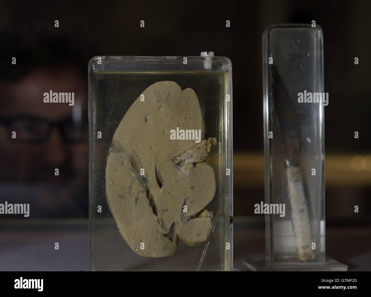 The anatomy of crime exhibition hi-res stock photography and images - Alamy