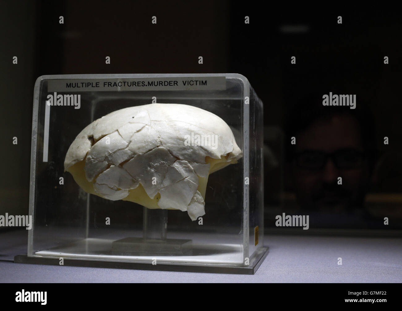 Forensics: the anatomy of crime exhibition. s Forensics: The anatomy of ...