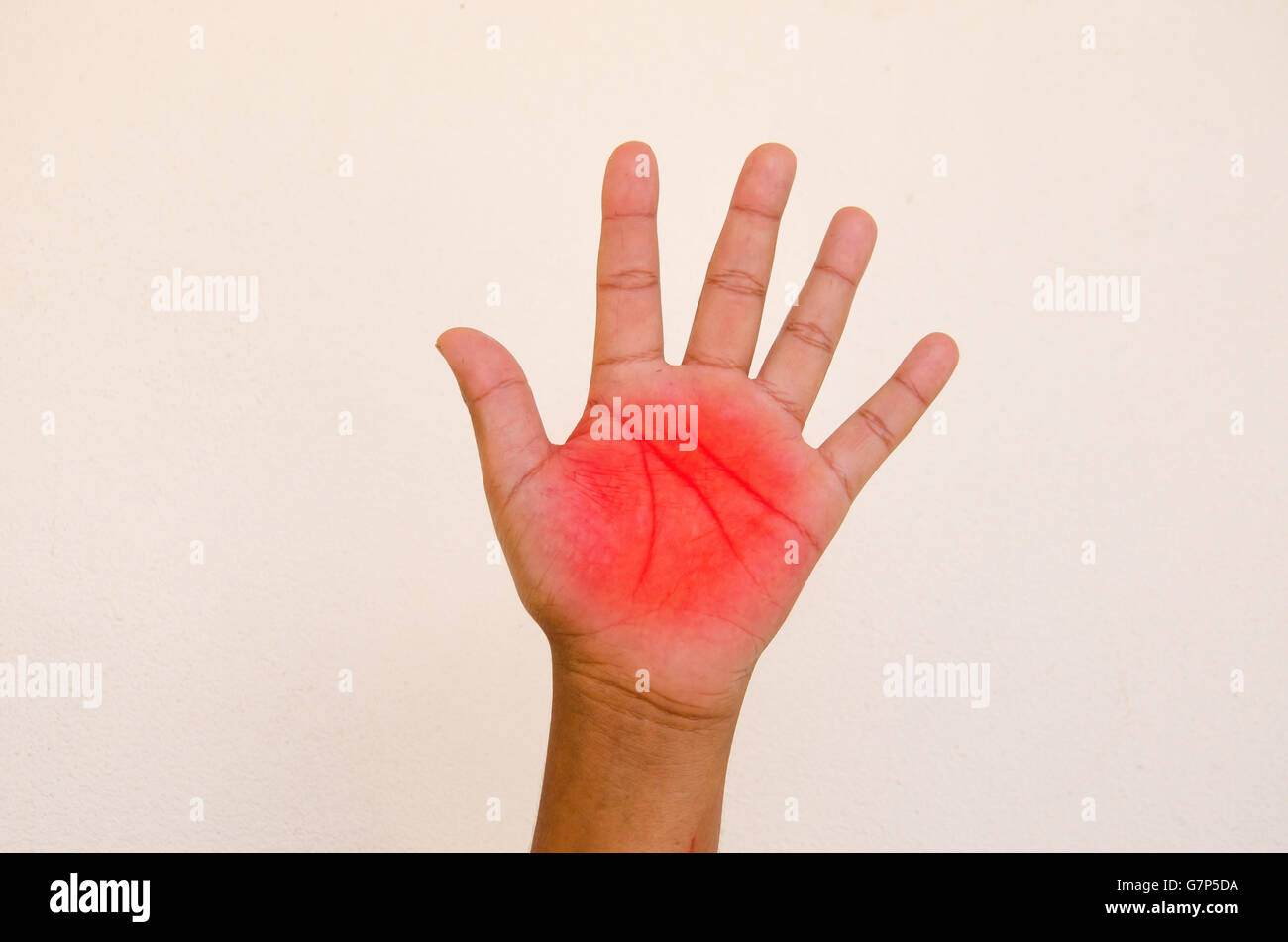 children hand with pain on white background Stock Photo - Alamy