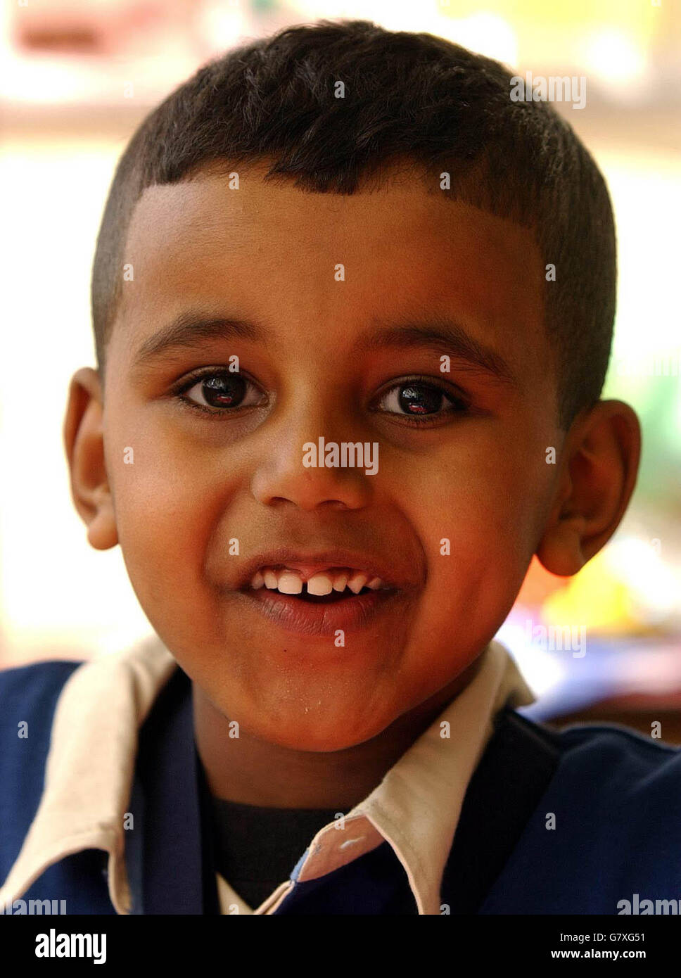 Mustaf has pioneering operation Stock Photo - Alamy