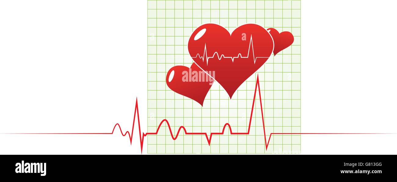 Medical heart beat hi-res stock photography and images - Alamy