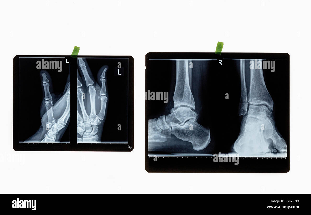 Hand leg Cut Out Stock Images & Pictures - Alamy