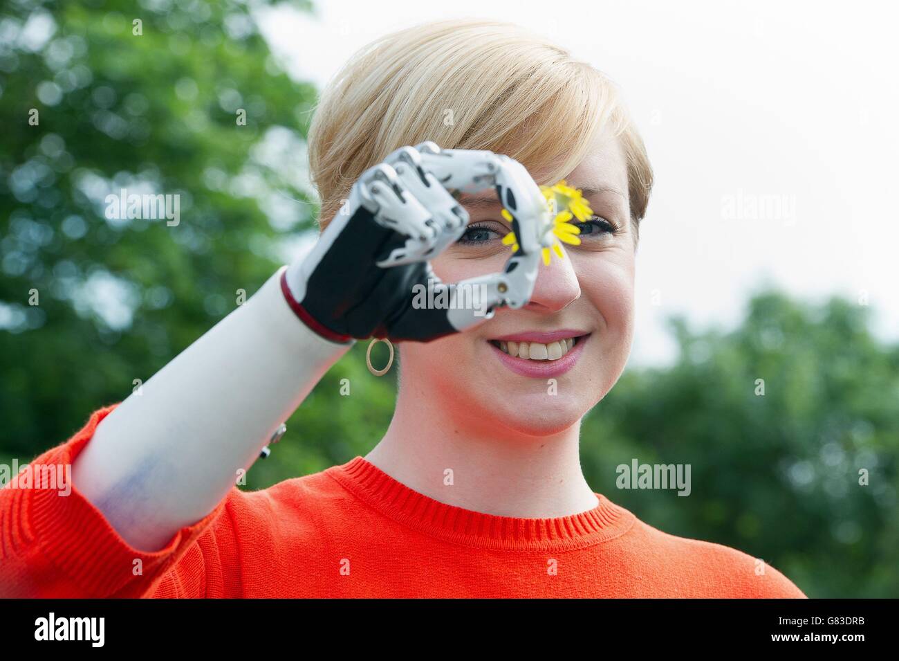 Nicky Ashwell, the UK's first patient to receive a lifelike bionic hand ...
