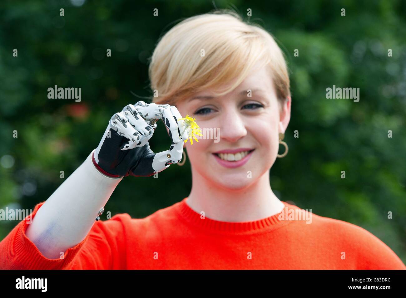 Nicky Ashwell, the UK's first patient to receive a lifelike bionic hand ...