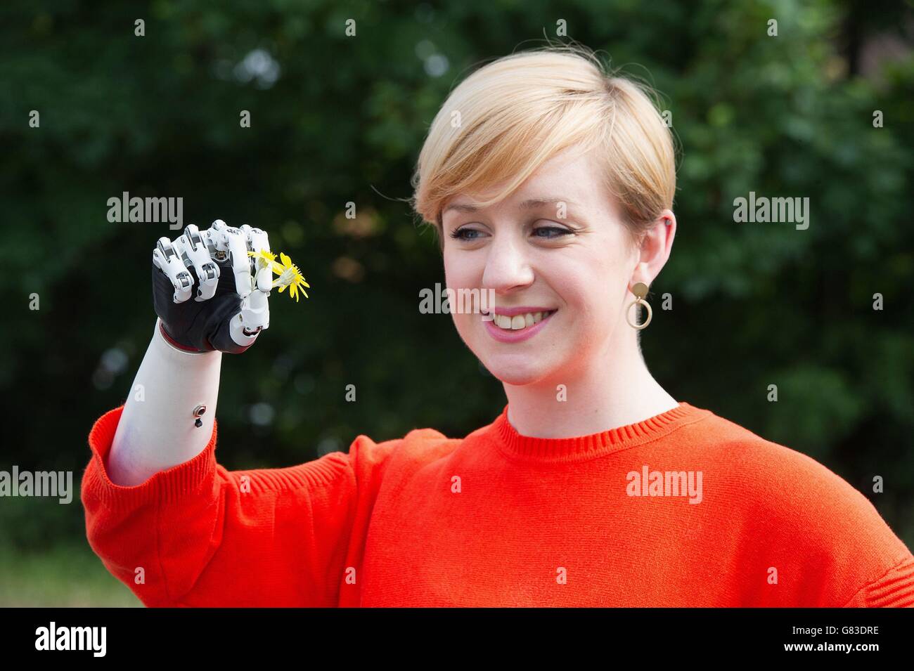 Bionic hand hi-res stock photography and images - Alamy
