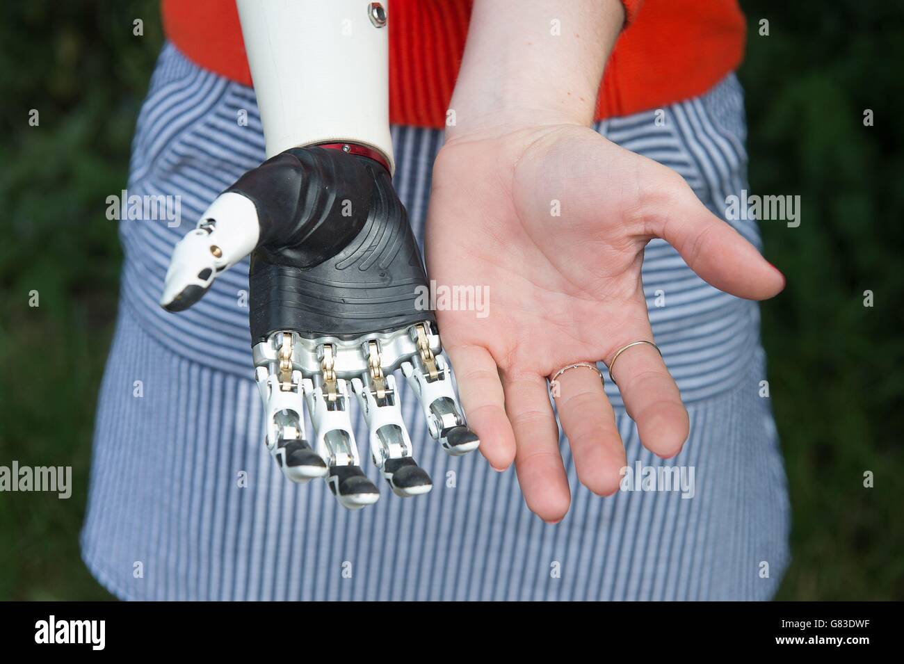 Bionic hand Stock Photo - Alamy