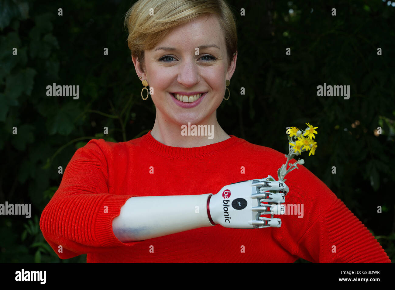Bionic prosthetic hand hi-res stock photography and images - Alamy