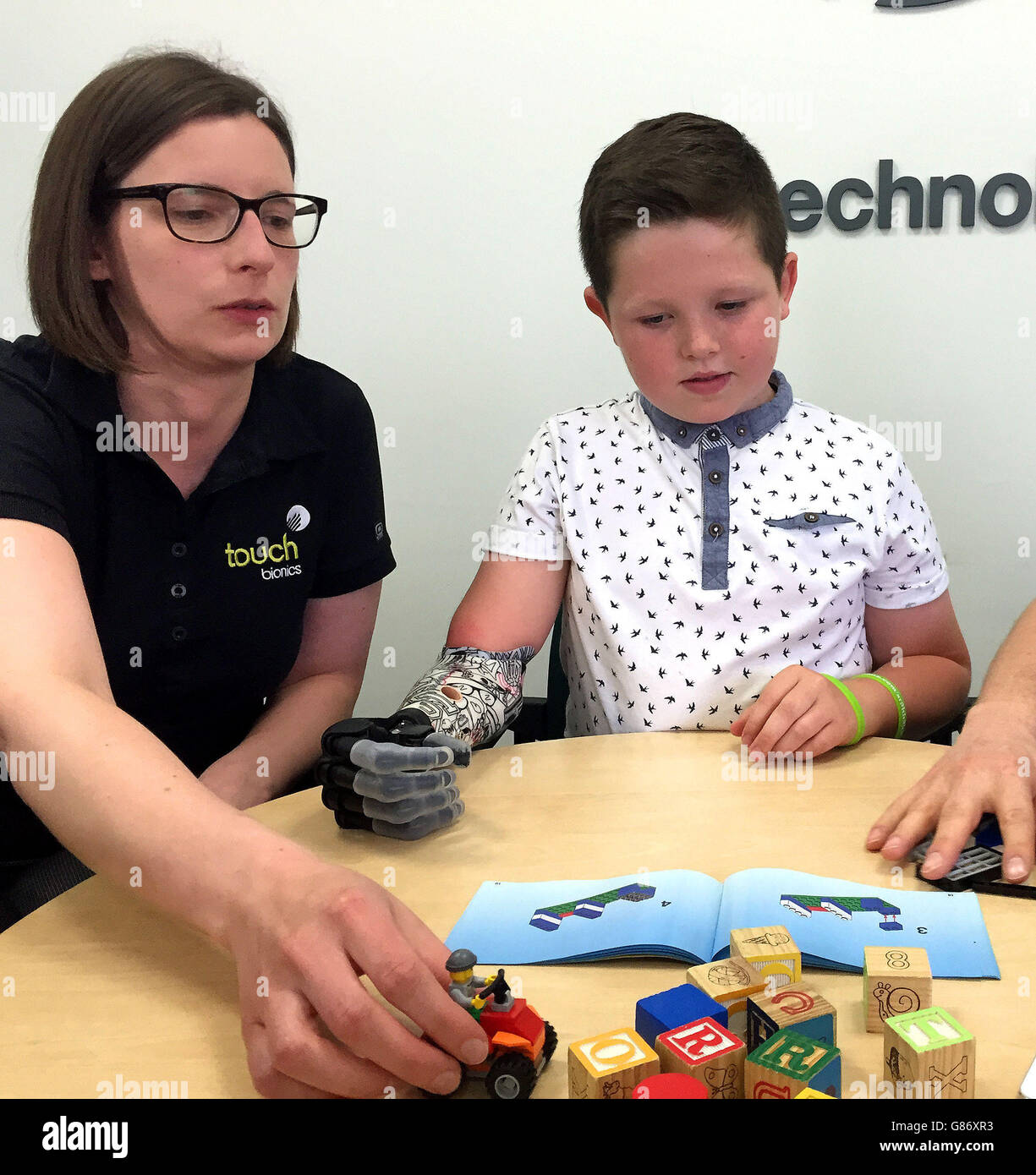 Prosthetic limb child hi-res stock photography and images - Alamy