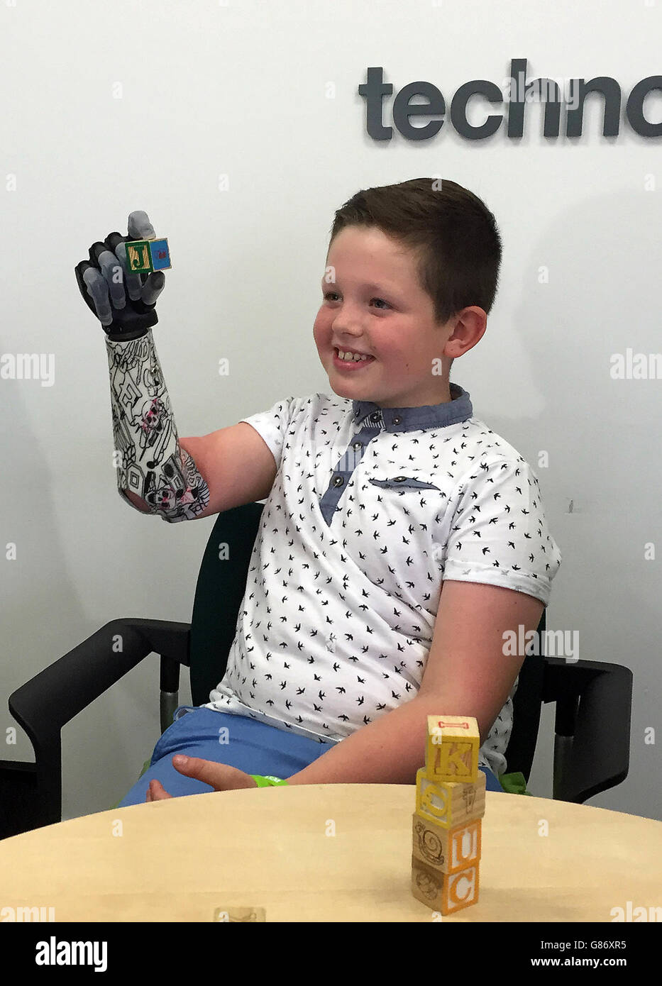 Who become first boy in uk fitted child sized bionic hand hi-res stock ...