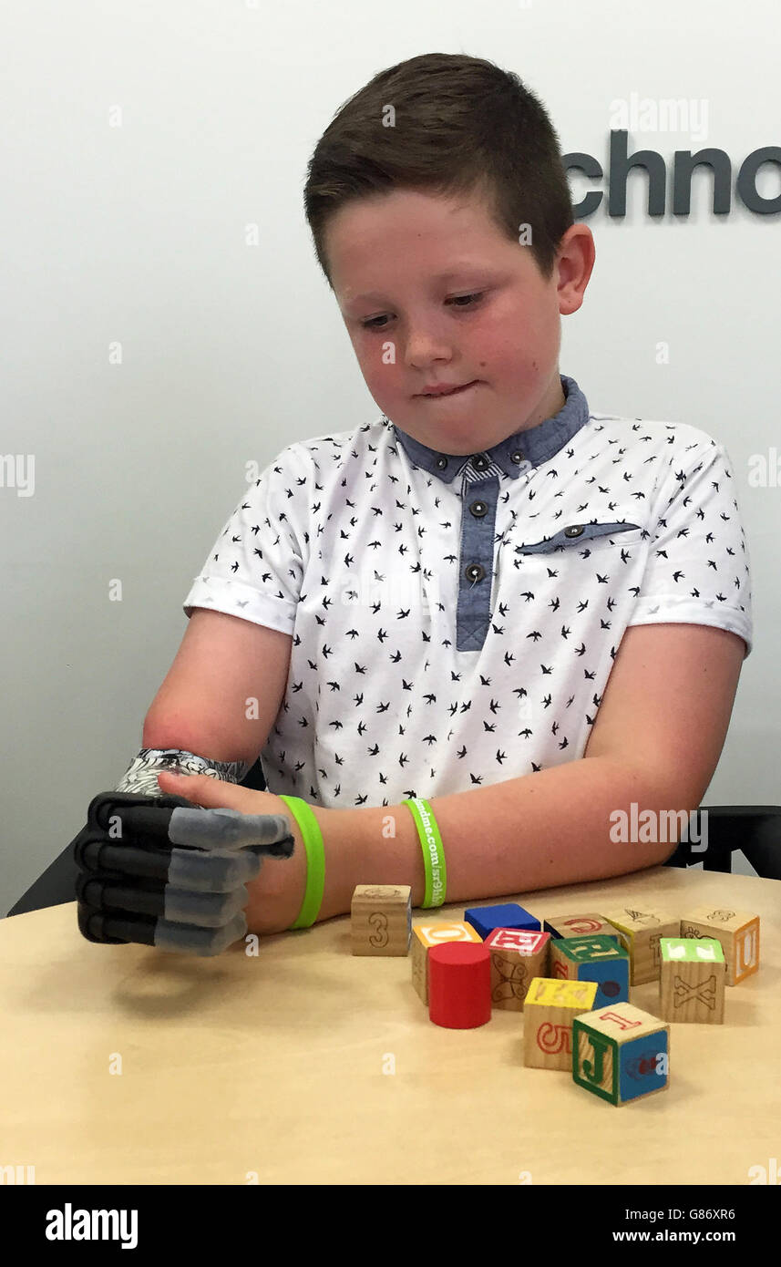 Boy fitted with bionic hand hi-res stock photography and images - Alamy