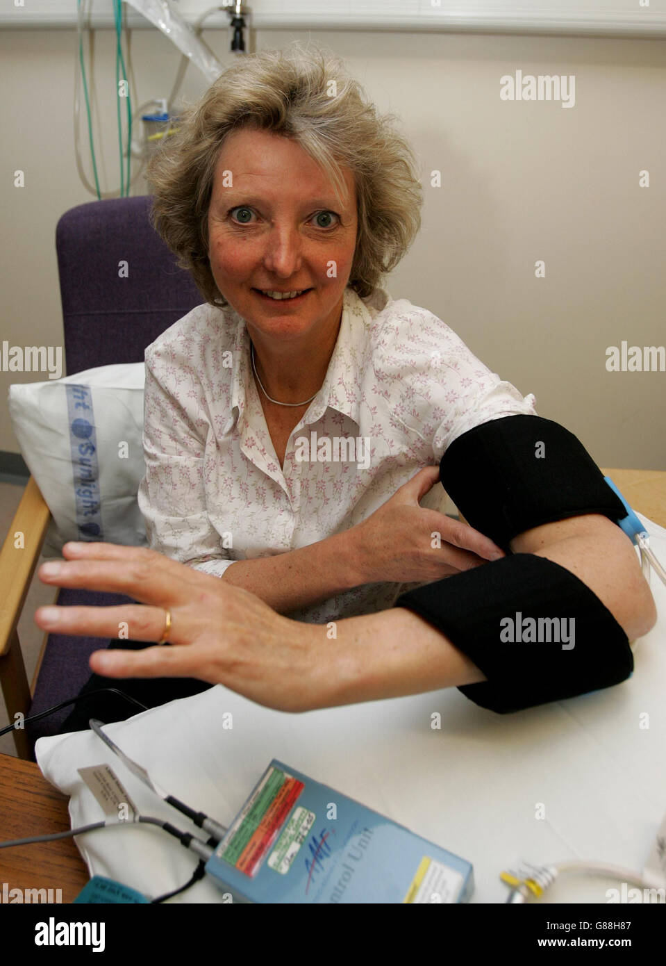 Bionic Arm - Southampton General Hospital Stock Photo - Alamy