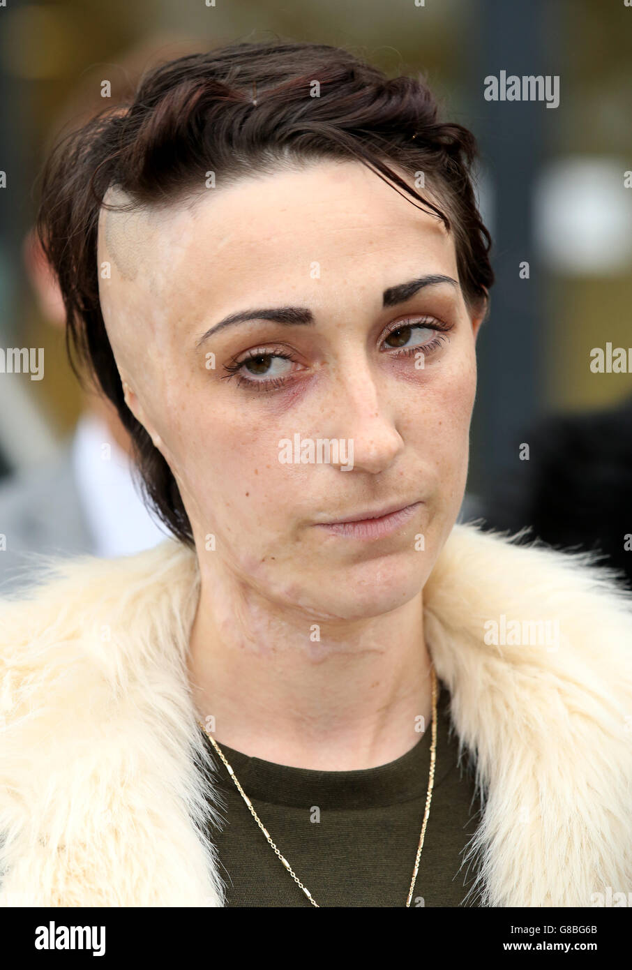 Acid attack court case Stock Photo - Alamy