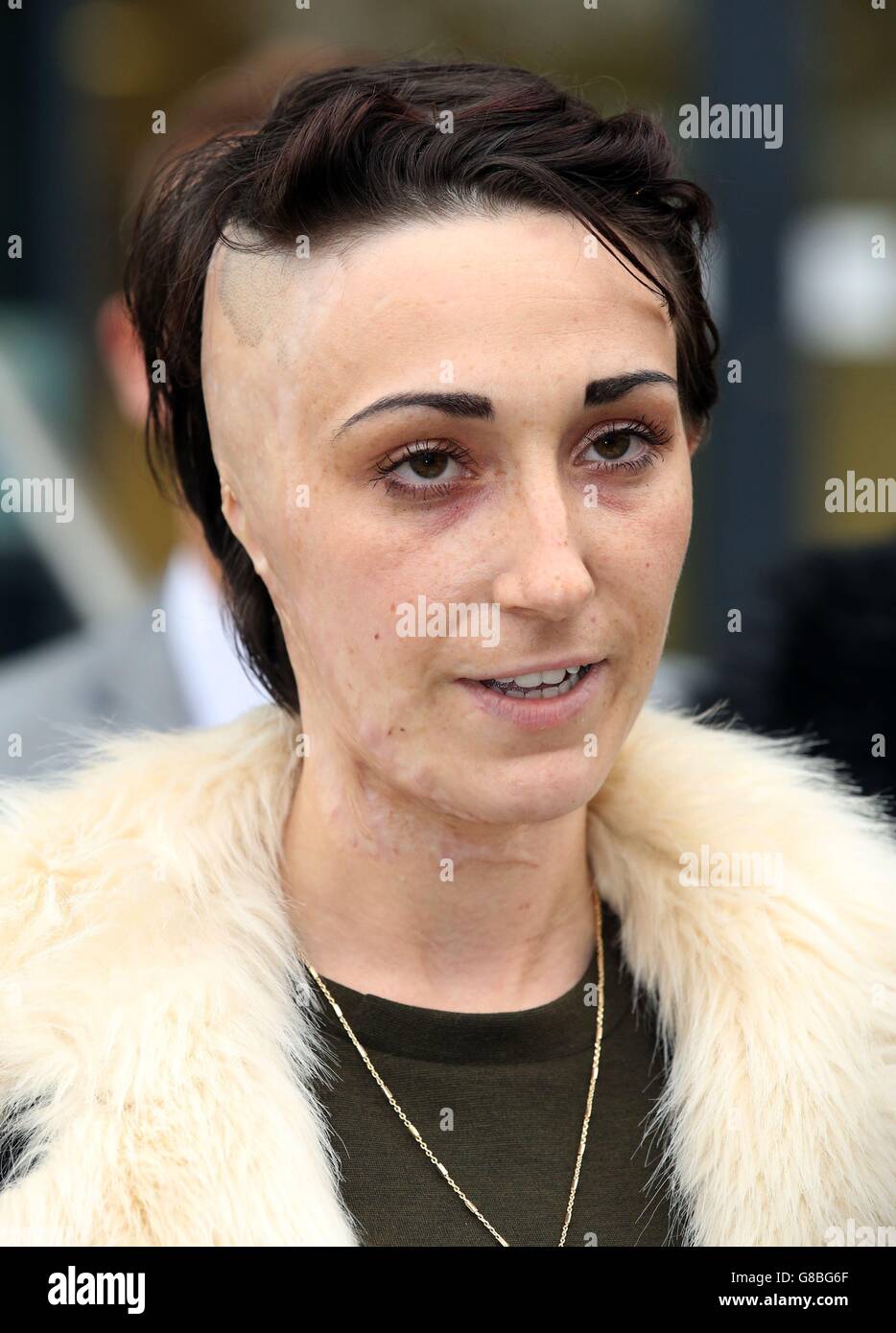 Acid attack court case hi-res stock photography and images - Alamy