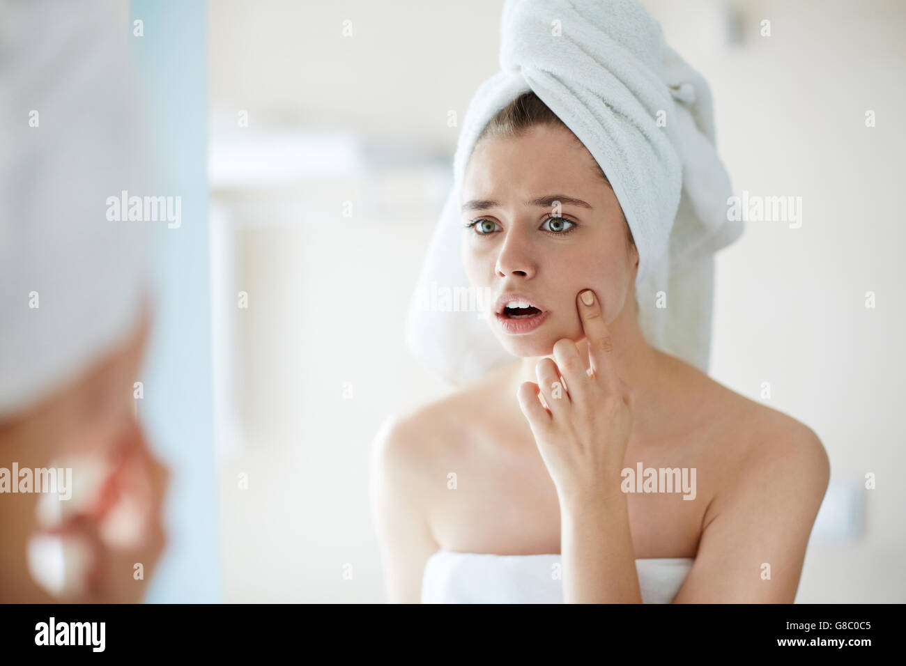 Pimple on cheek Stock Photo - Alamy