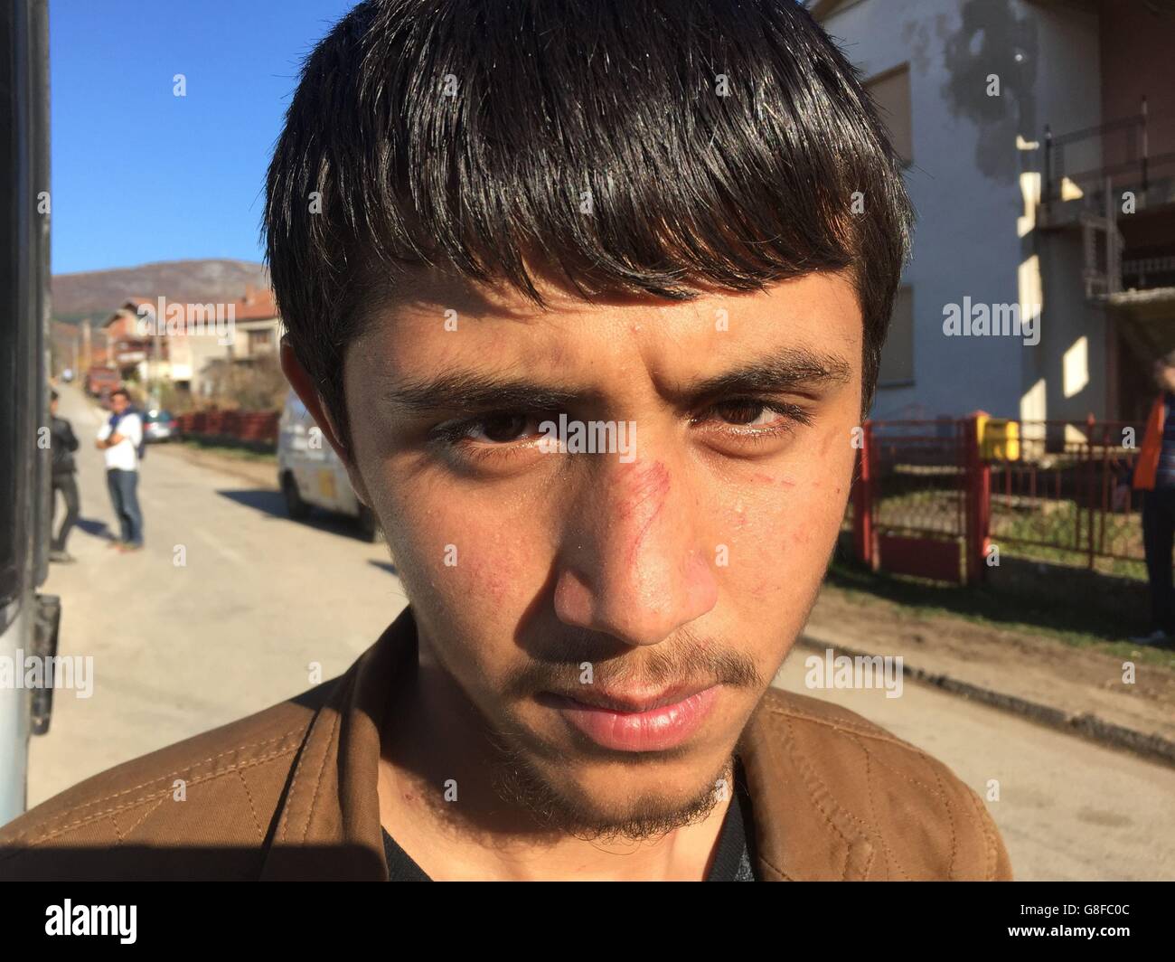 Afghan refugee Hamayoon Noorhaman, 15, in Dimitrovgrad, Serbia, who ...