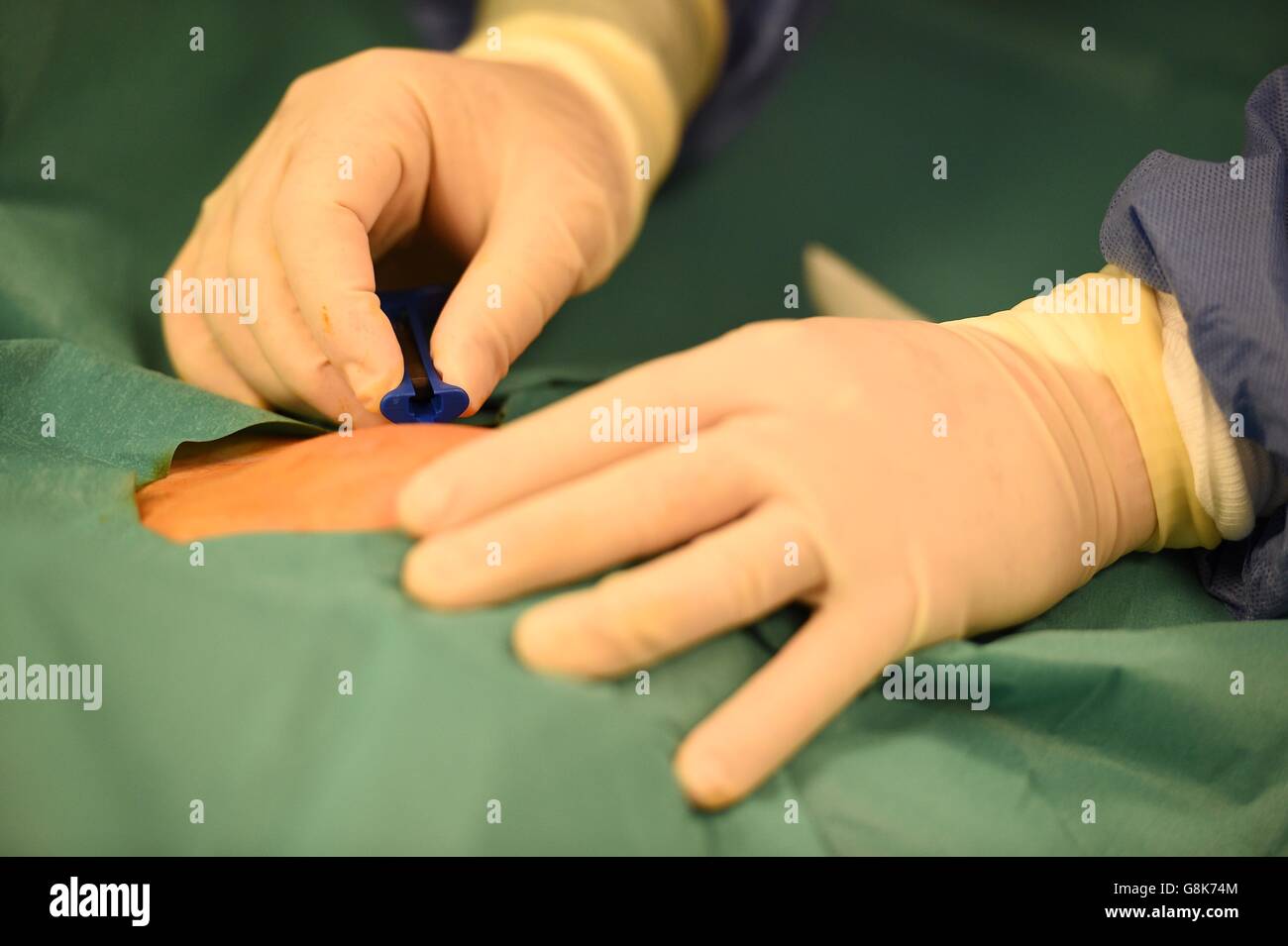 Poole Hospital Consultant Cardiologist Dr Christopher Boos closes a ...