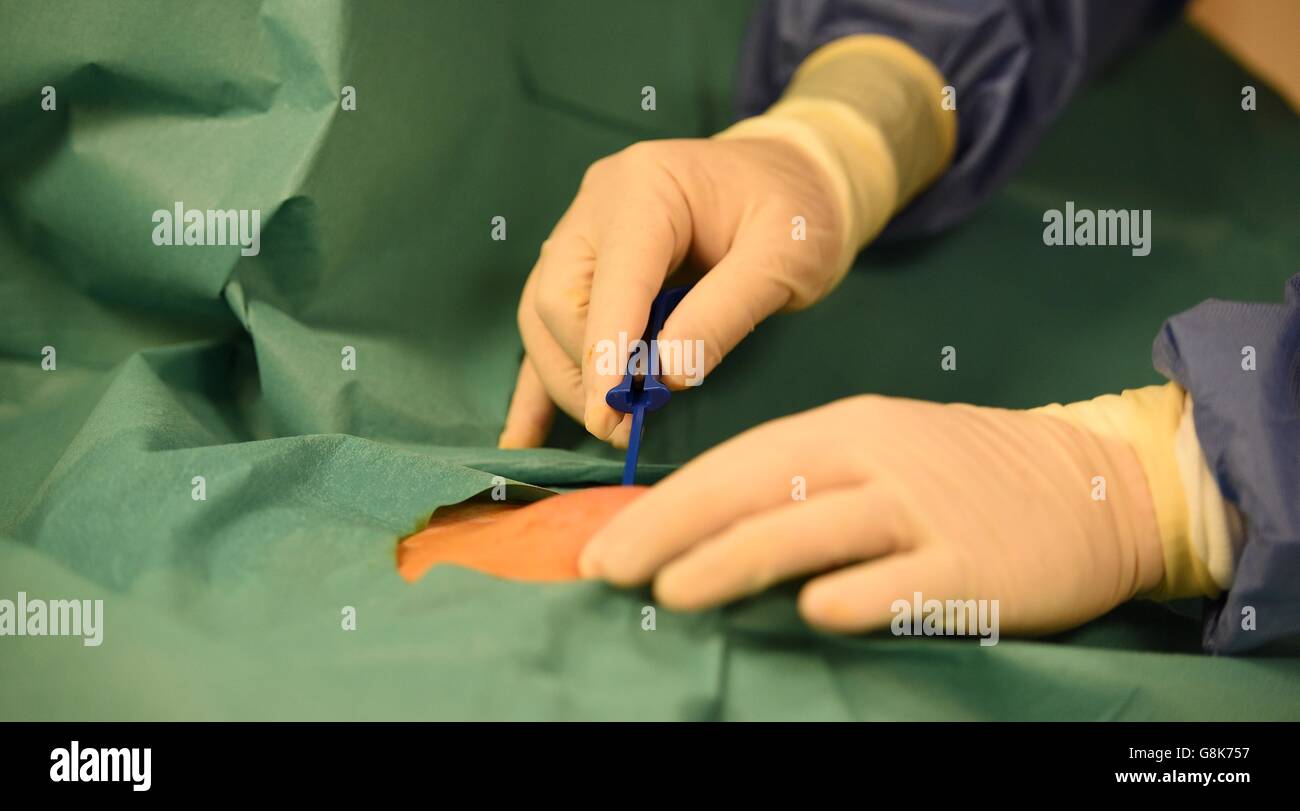 Poole Hospital Consultant Cardiologist Dr Christopher Boos injects a ...