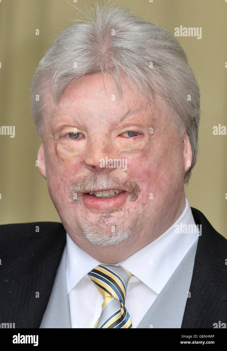 Falklands veteran who overcame horrific facial injuries become charity ...