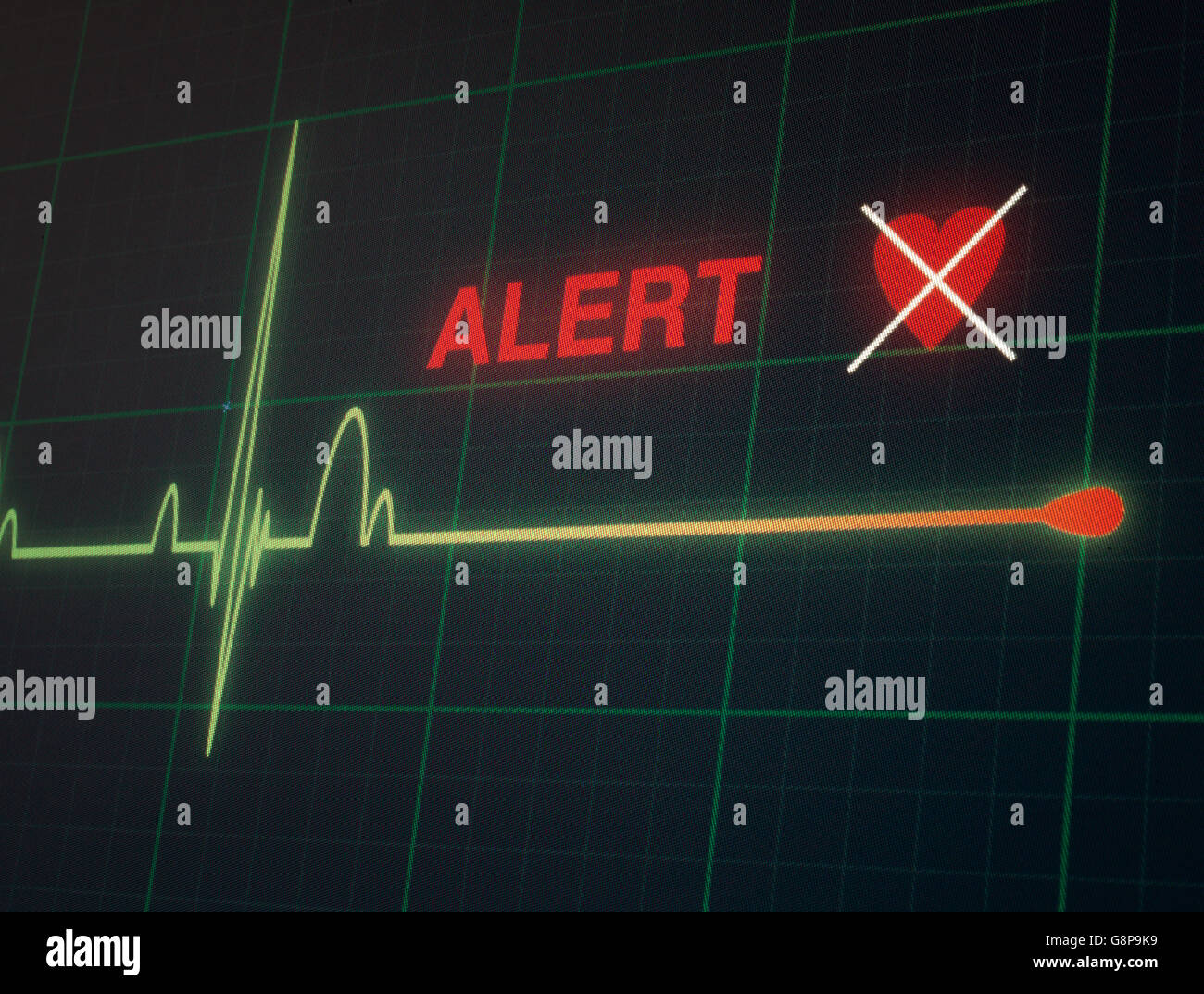 Heart beats cardiogram on the monitor Stock Photo - Alamy