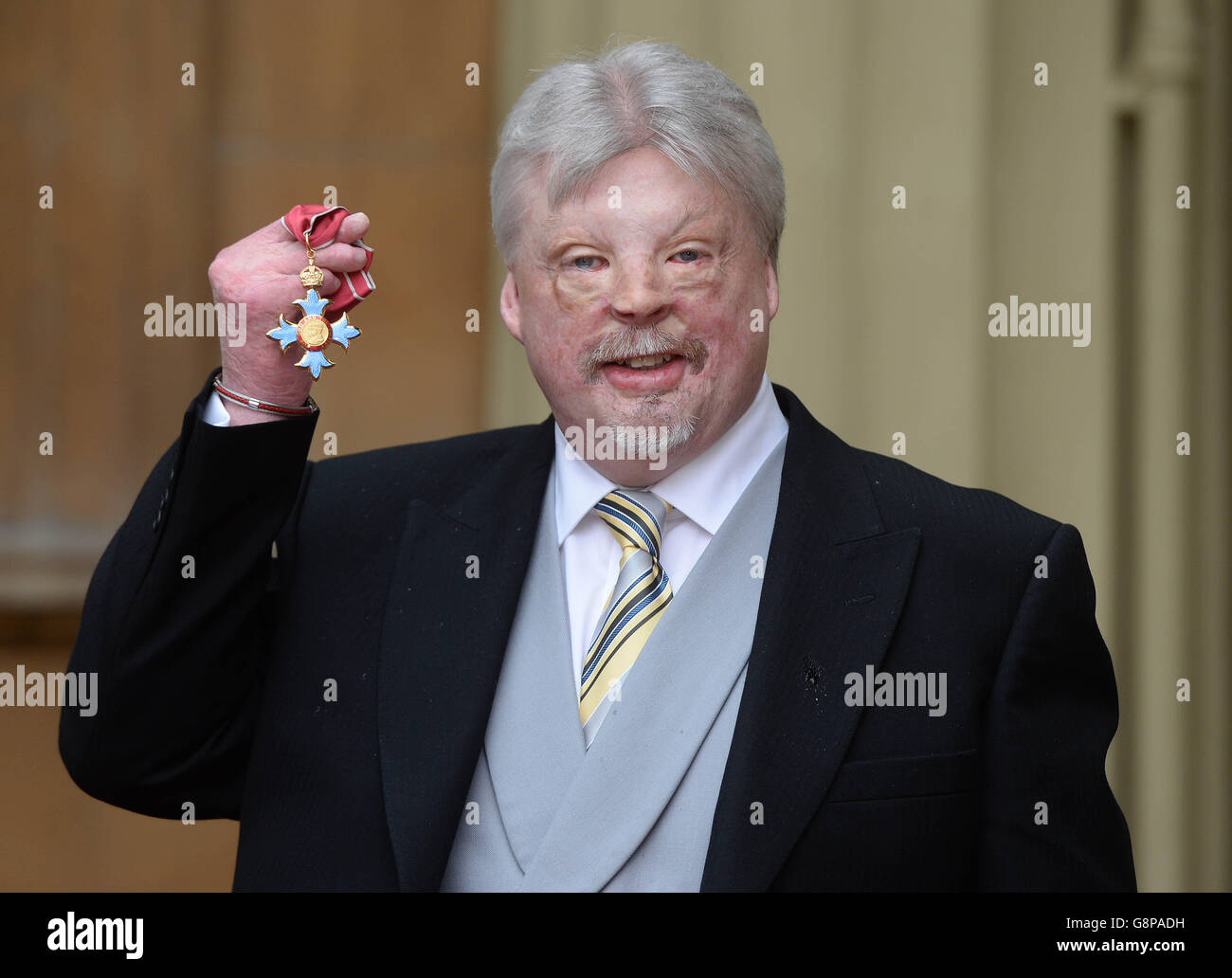 Simon Weston, the Falklands veteran who overcame horrific facial ...