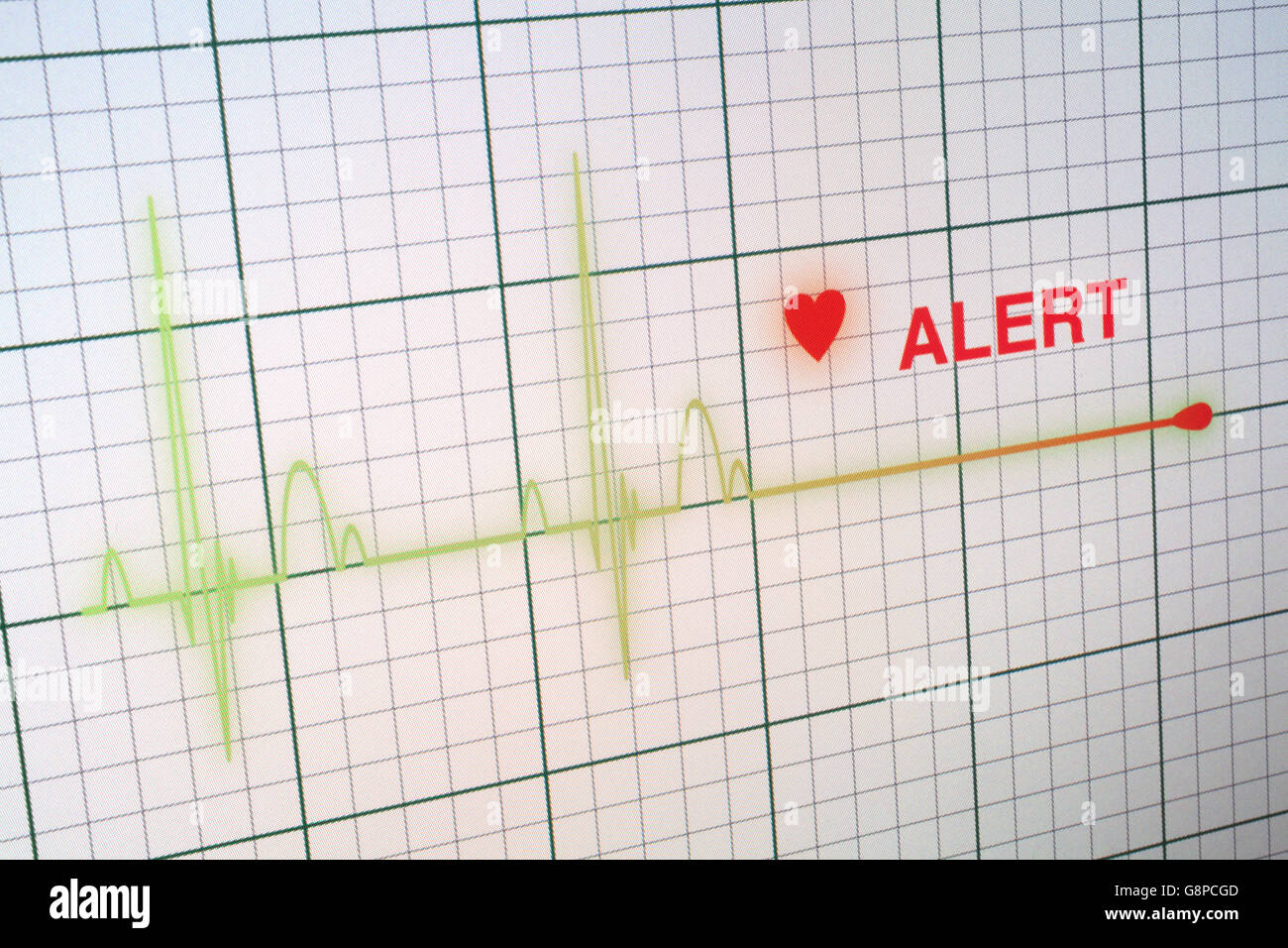Ecg Monitor Death High Resolution Stock Photography and Images - Alamy