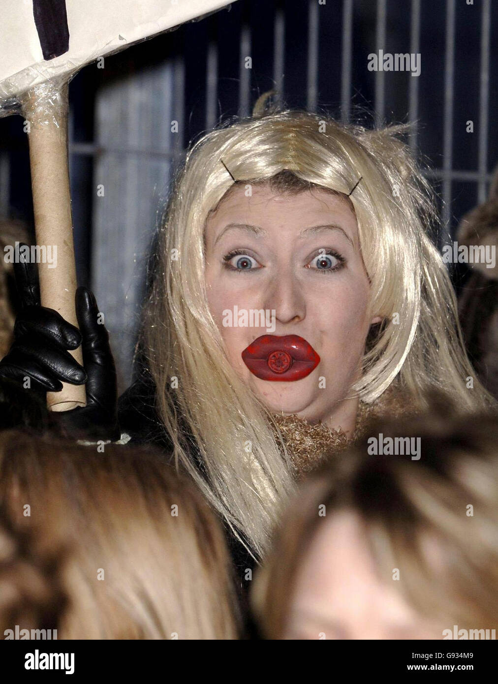 Pete Burns Lips Explode