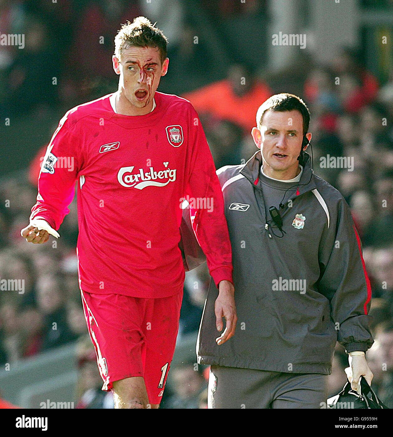 Liverpool's Peter Crouch leaves the pitch for treatment after a ...