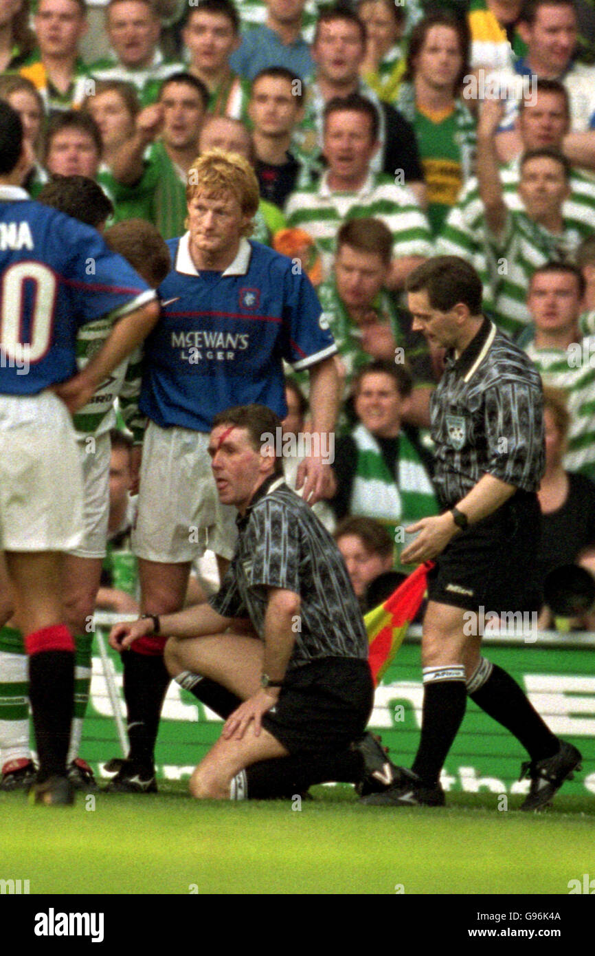 Colin Hendry of Rangers stands over injured referee Hugh Dallas, as ...