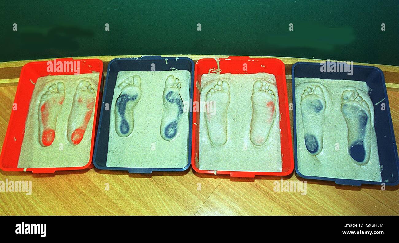 Feet moulds tray plaster football man utd hi-res stock photography and ...