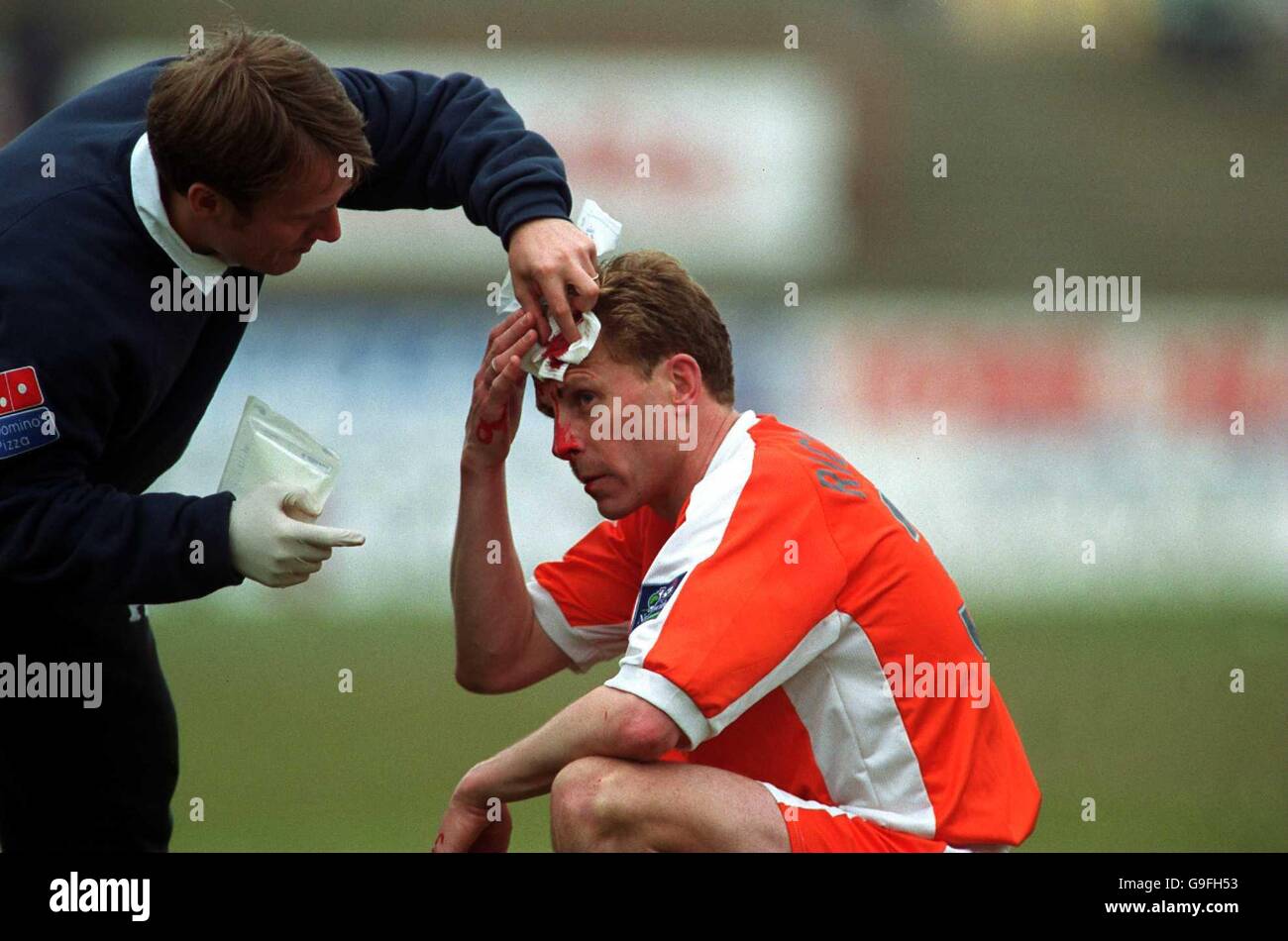 Gash on forehead hi-res stock photography and images - Alamy
