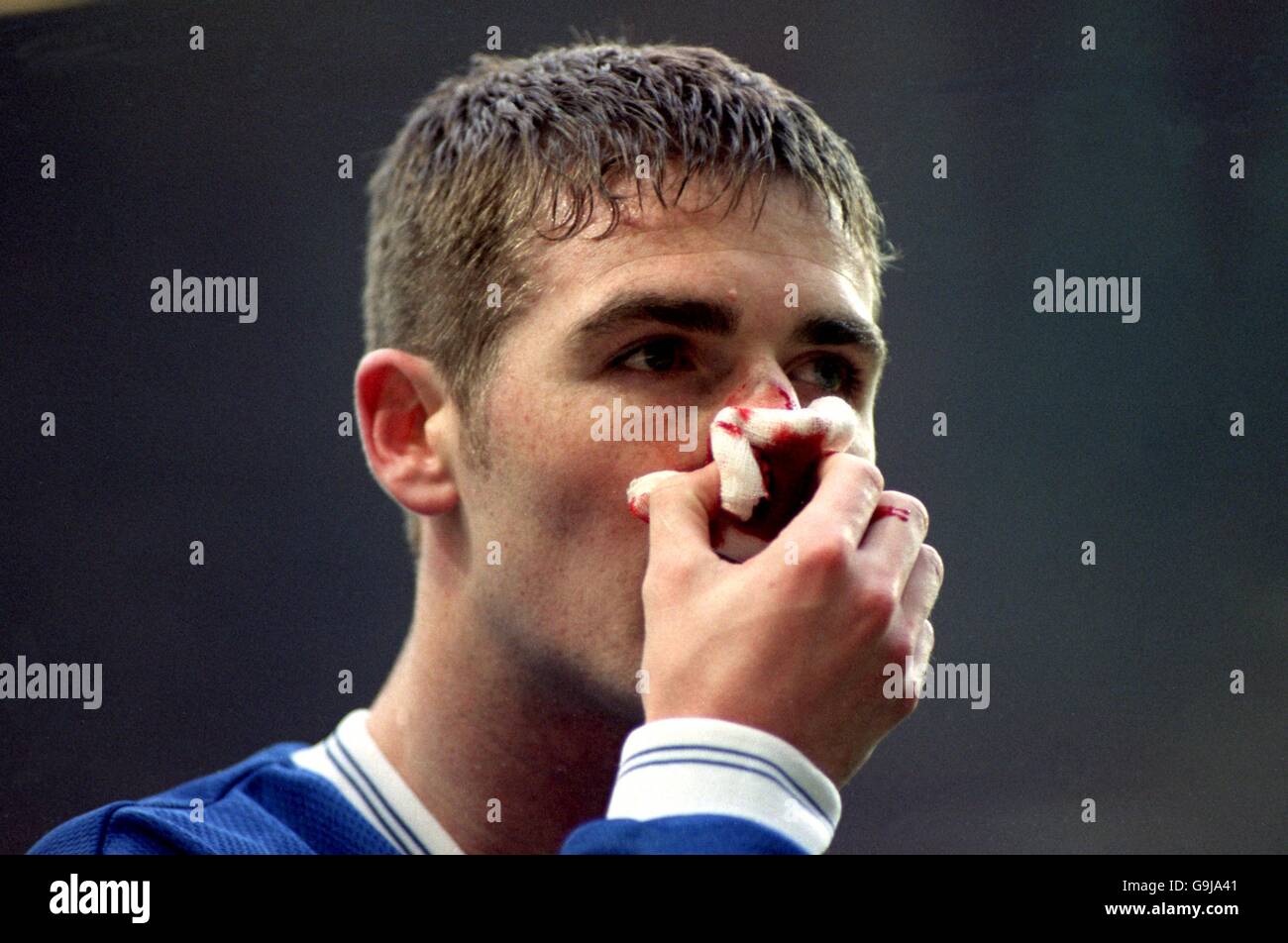 Birmingham citys bryan hughes tends to his bloodied nose hi-res stock ...