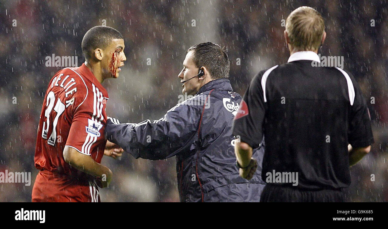 Liverpool's Lee Peltier bleeding during the Carling Cup third round at ...