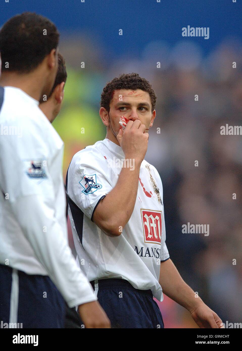 Tottenham hotspurs ghaly holds his face after losing four teeth hi-res ...