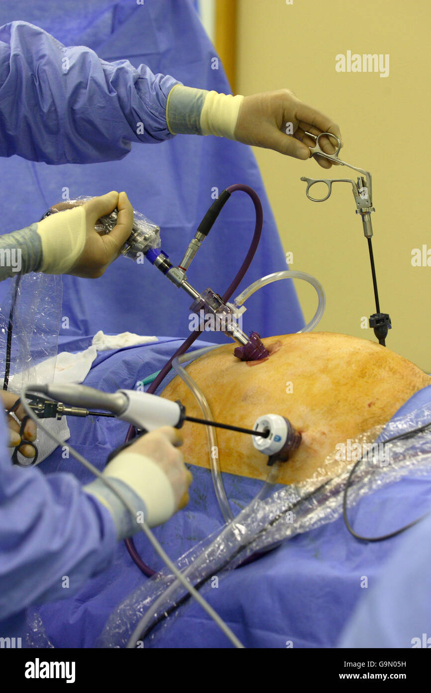 STOCK Health operation Generic Health pics Stock Photo - Alamy