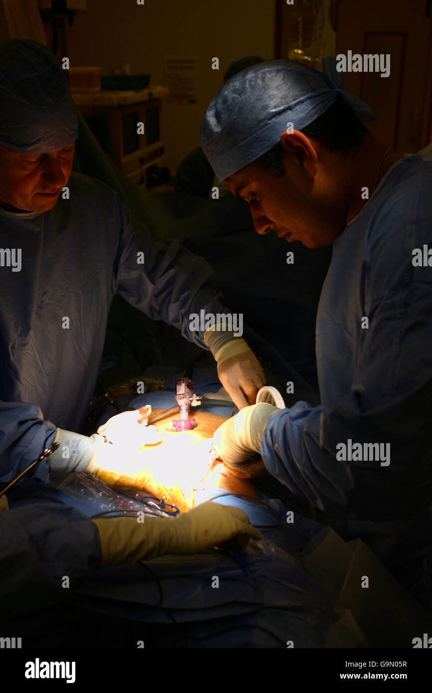 STOCK Health operation Generic Health pics Stock Photo - Alamy