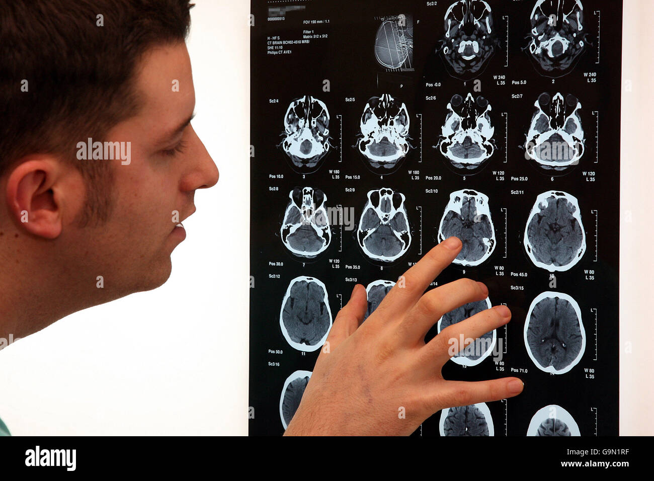 Generic Health pics Stock Photo - Alamy