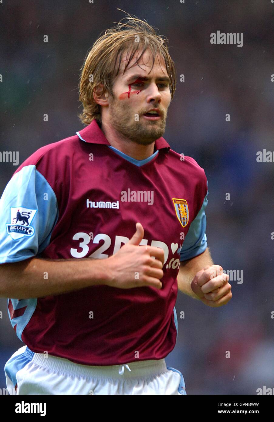 Soccer football blood bleeding hi-res stock photography and images - Alamy