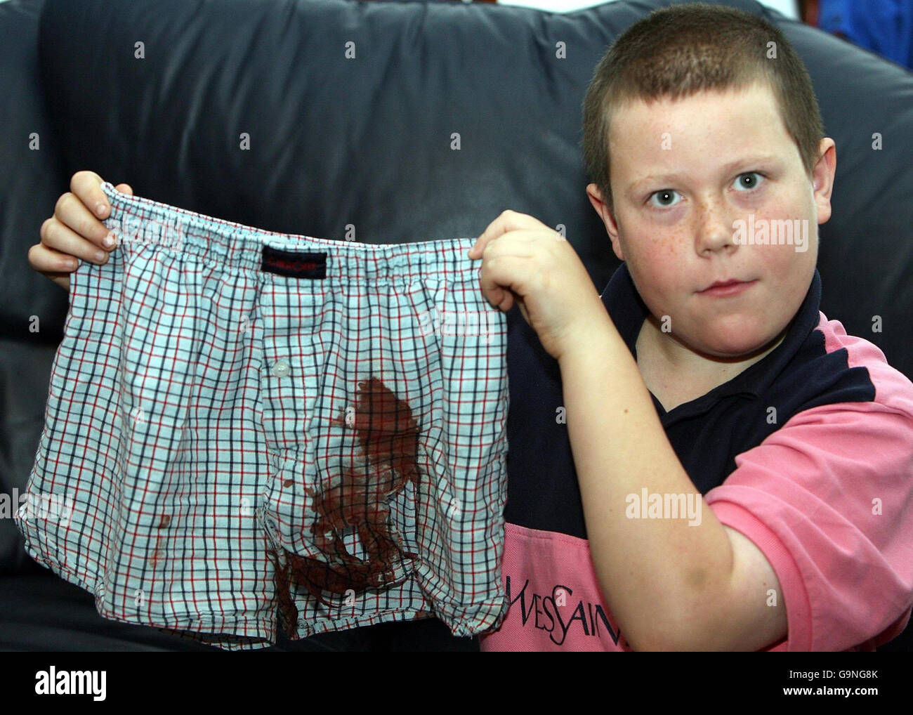 Adam Patrick Boyd, 10, from West Denton in Newcastle, shows his damaged ...