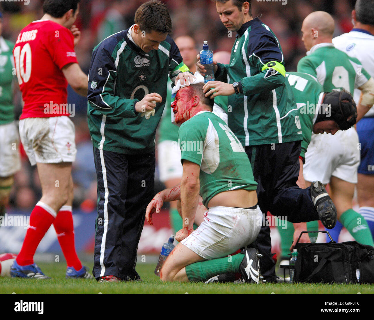 Rugby head injury hi-res stock photography and images - Alamy