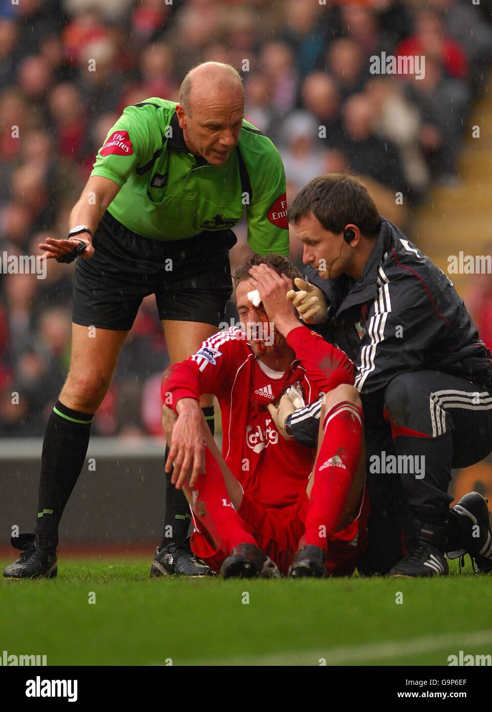Liverpool's Peter Crouch recieves treatment for a head injury Stock ...