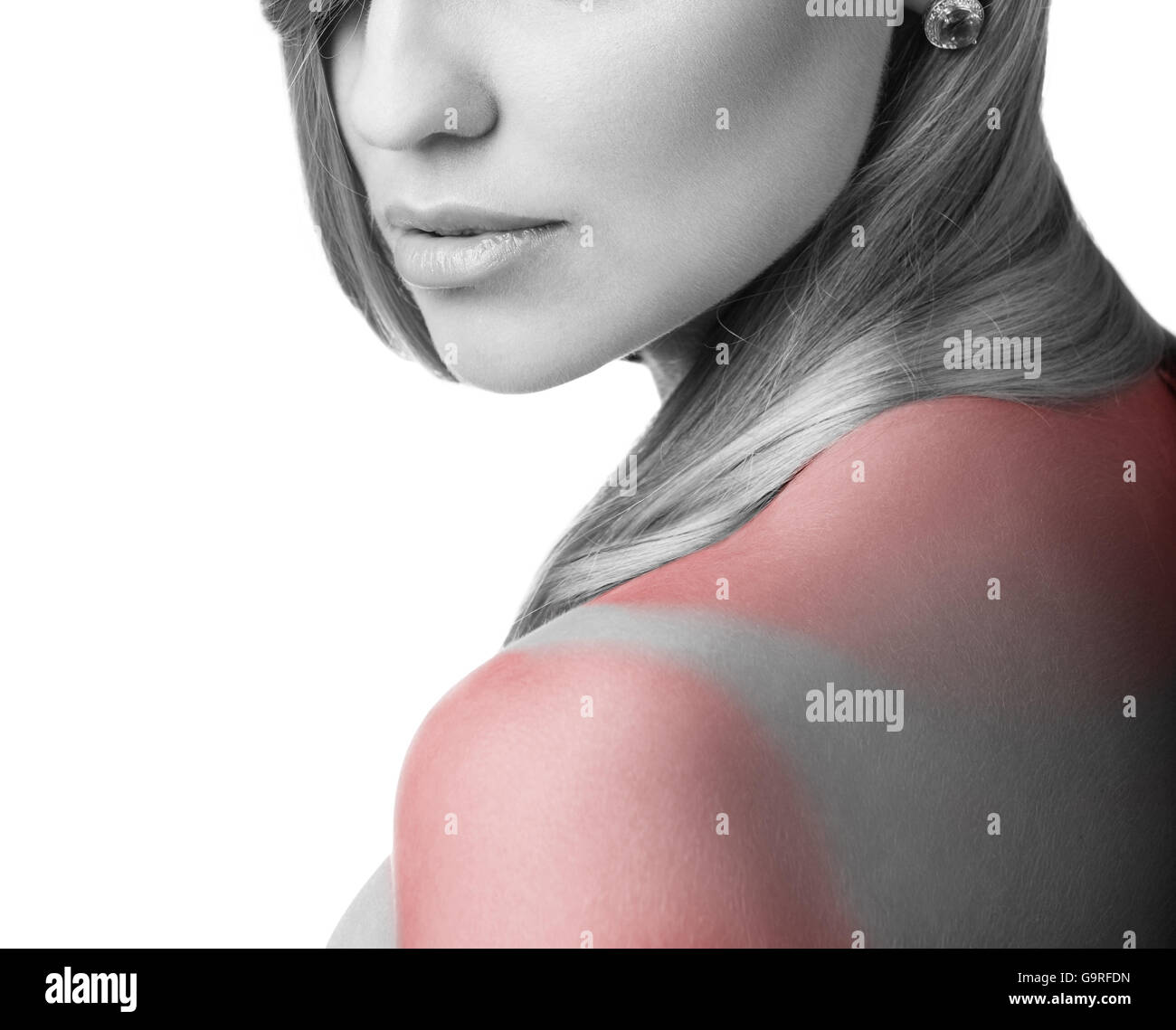 Woman sunburned hi-res stock photography and images - Alamy
