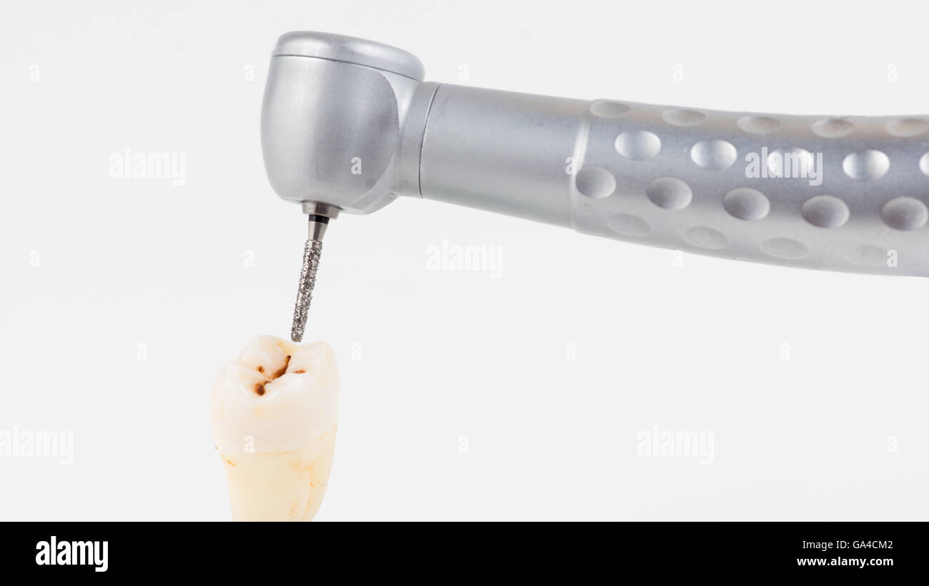 dentist using dental turbine handpiece for dental treatment Stock Photo ...