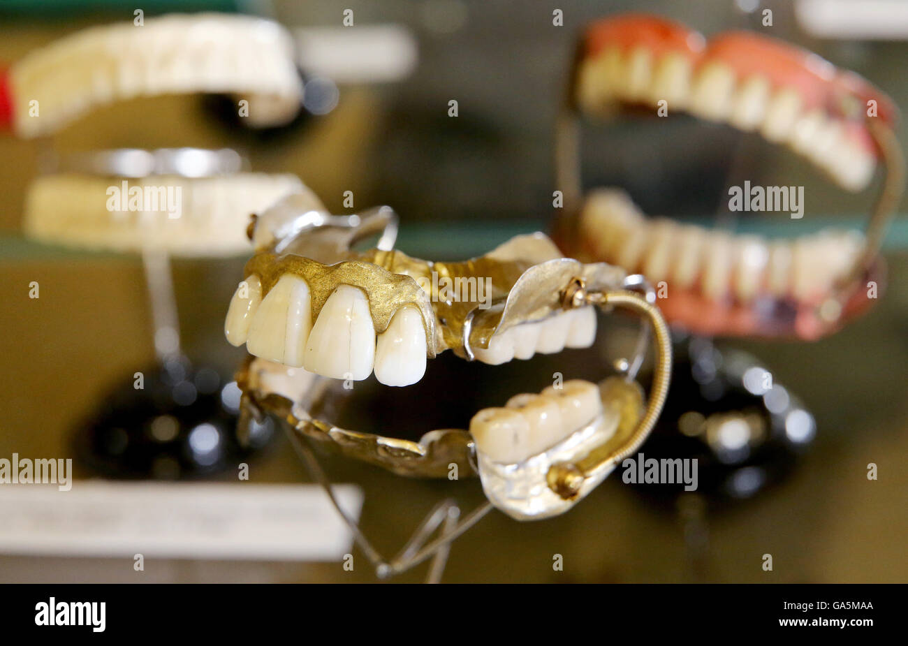 Waterloo teeth hi-res stock photography and images - Alamy