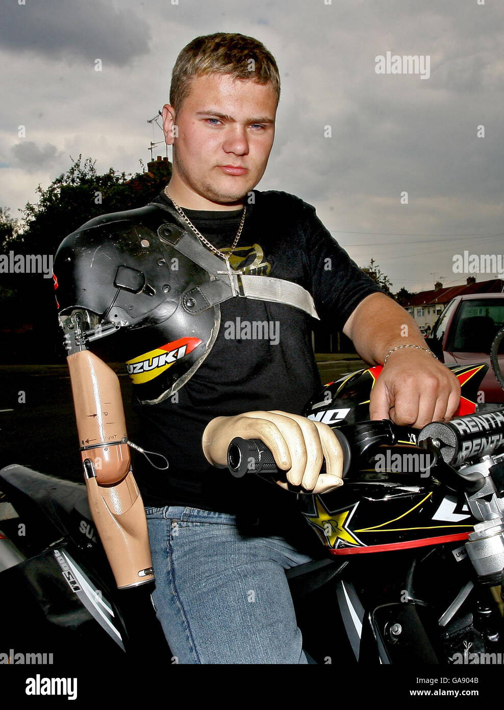 Jack Baker, 19, who had his prosthetic hand, worth 450, stolen after he ...