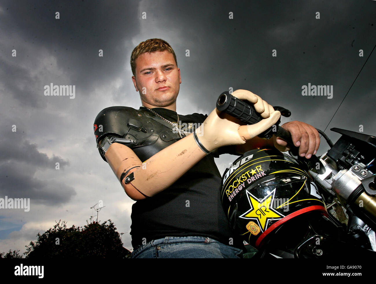 Jack Baker, 19, who had his prosthetic hand, worth 450, stolen after he ...