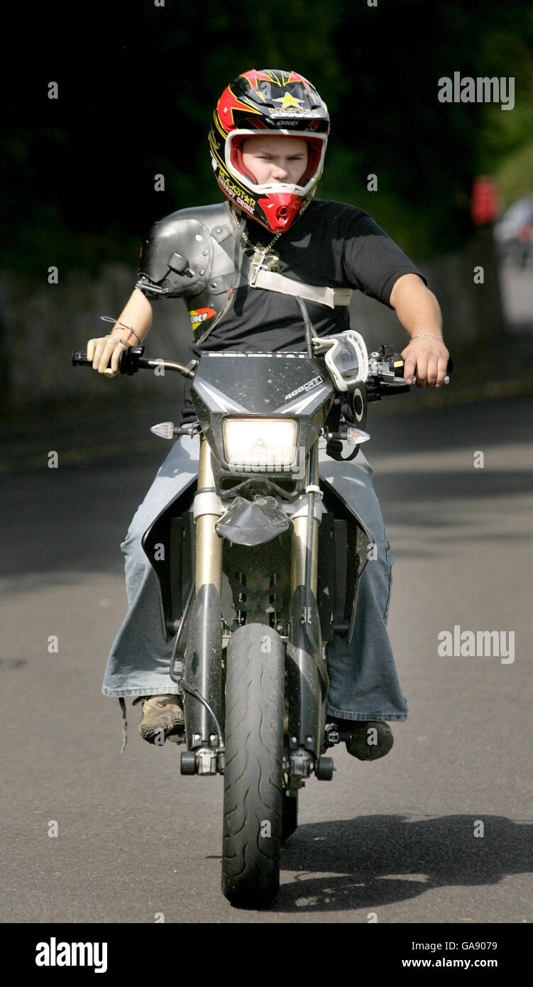 Jack Baker, 19, who had his prosthetic hand, worth 450, stolen after he ...