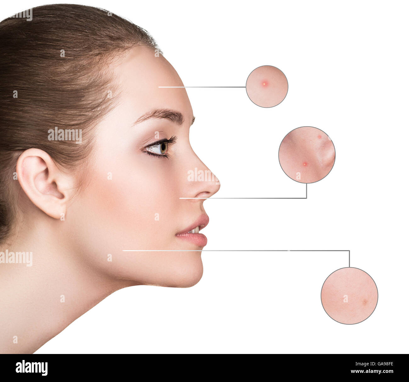 Female face with zoom circles isolated on white background. Problem ...