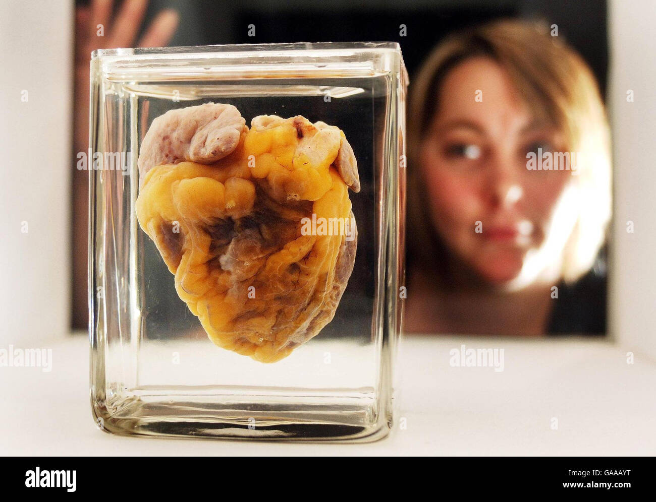 Jennifer sutton heart hi-res stock photography and images - Alamy